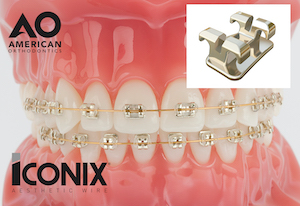 Charlotte Advanced Orthodontics | Iconix Aesthetic Braces | Port Charlotte Arcadia FL